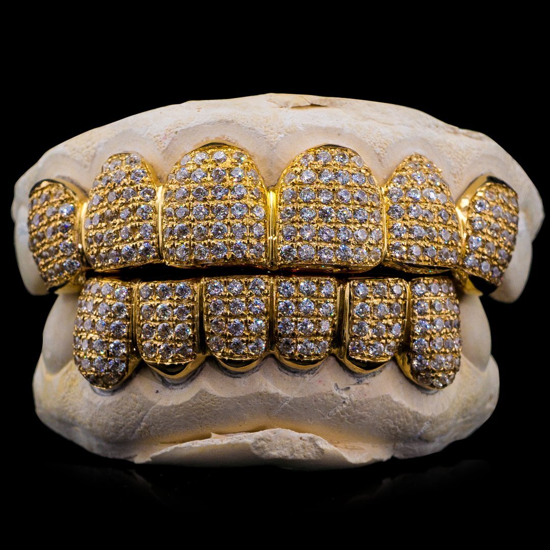 10k vs 14k vs 18k vs 24k Gold for Grillz [All You Need To Know ...