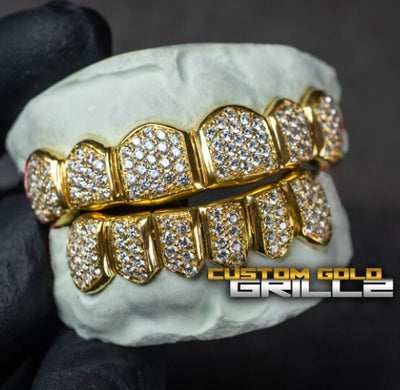 How Much Do Diamond Grill Cost? [Detailed Explaination] - Custom Gold ...