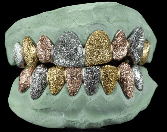 What are Diamond Dust Grillz [Expert Guide] - Custom Gold Grillz
