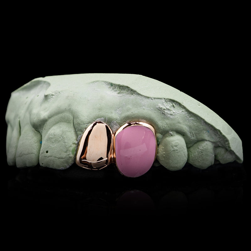 Custom Enamel Solid Double Cap Grillz – Personalized Color Style ...