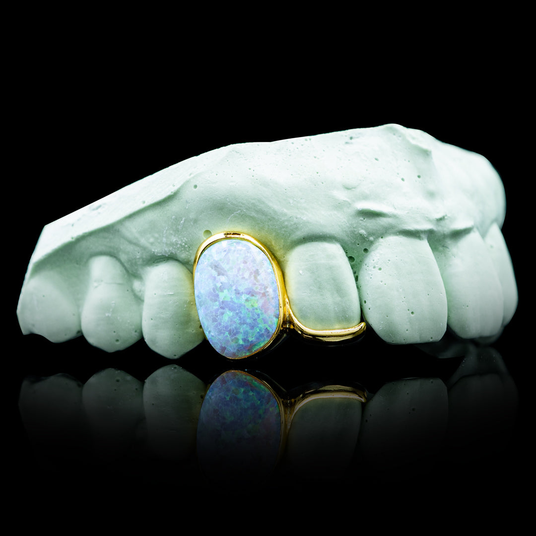 Opal and Solid Tip Double Cap Grillz - Custom Colors in Gold or Silver ...