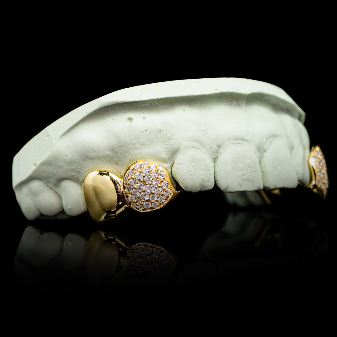 Double Cap Top Grillz - Solid and Iced VVS Moissanite - Custom Gold Grillz