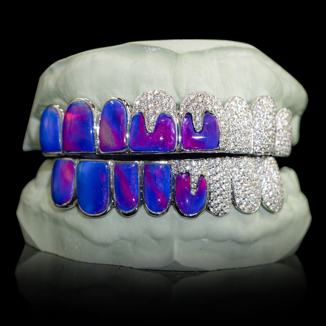 Opal Grillz - Custom-Fit Gold and Silver Teeth with Opal Inaly - Custom ...