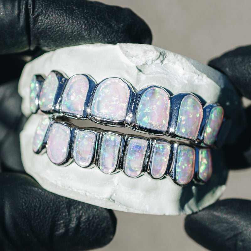 Opal Grillz - Custom-Fit Gold and Silver Teeth with Opal Inaly - Custom ...