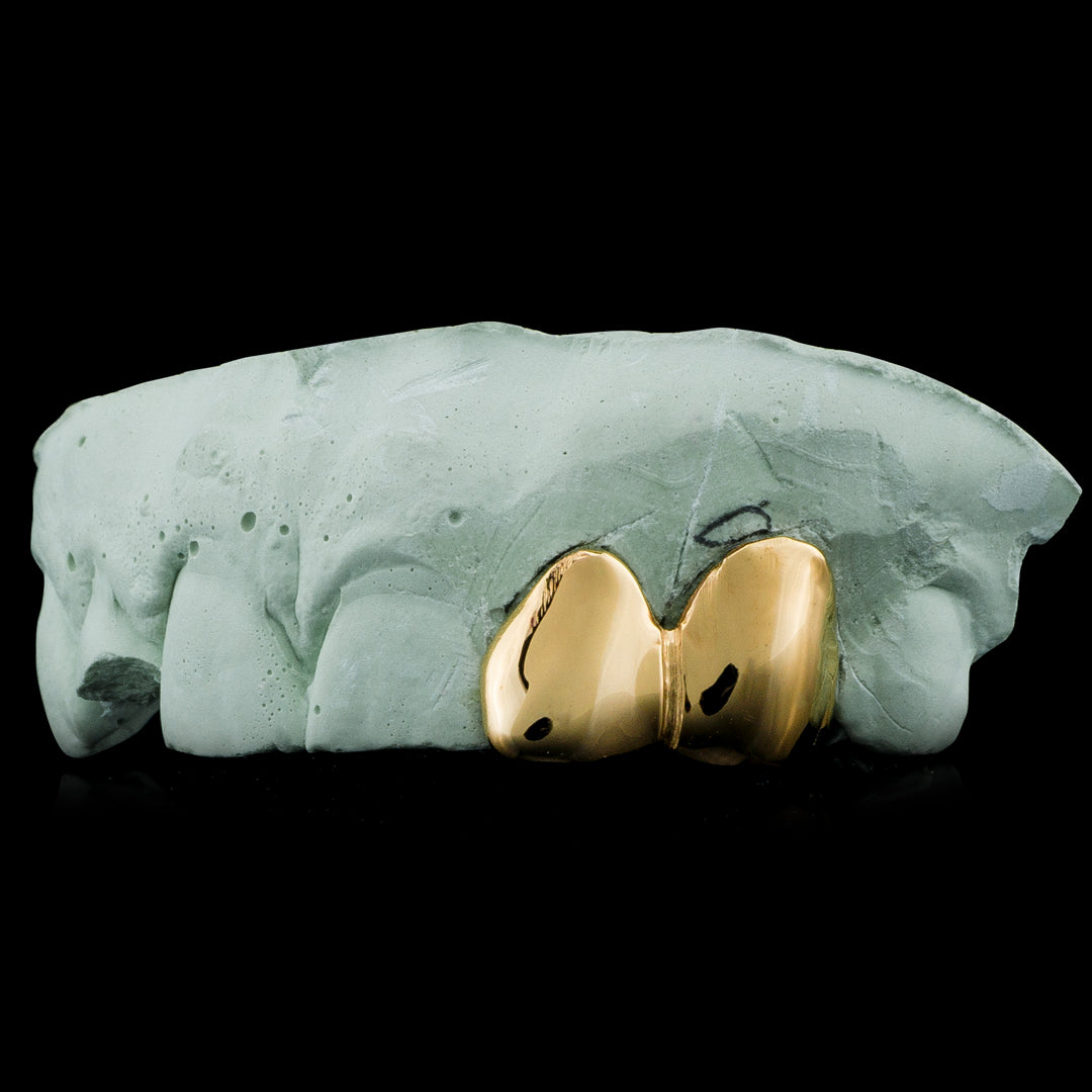 Solid Gold Double Cap Tooth Grillz - Custom Gold Grillz