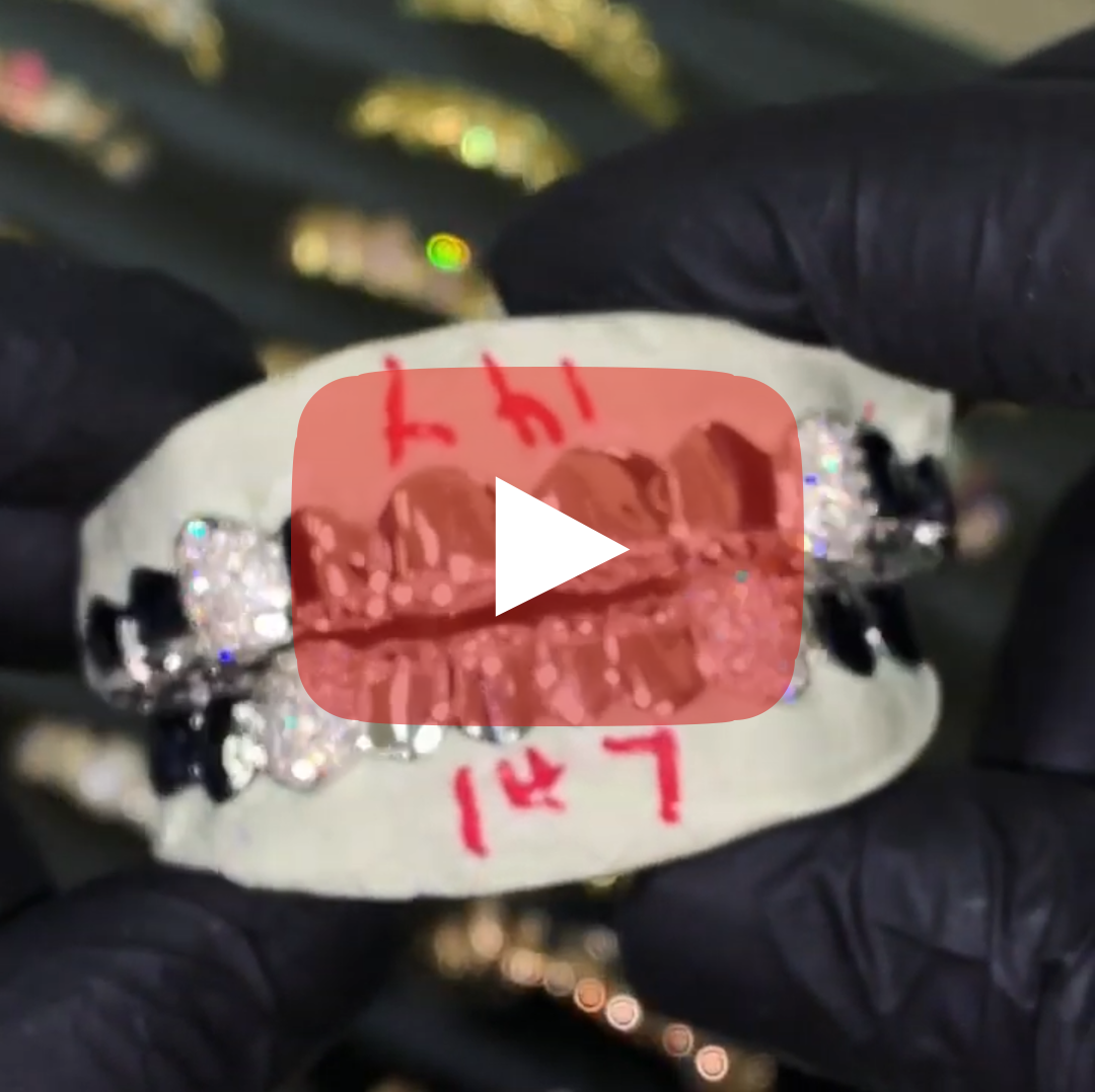 Buy Custom Iced Out Grillz - Custom Gold Grillz