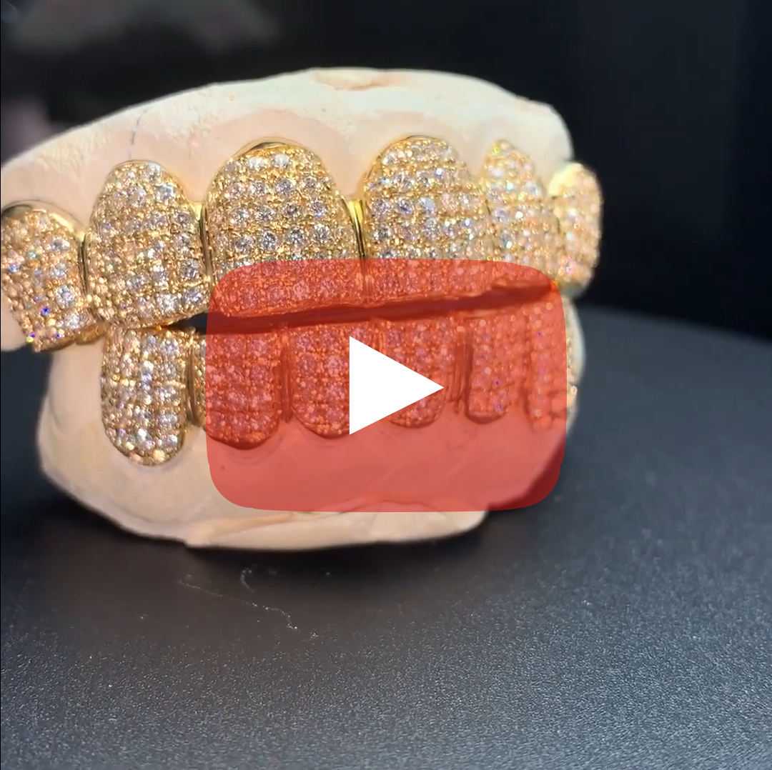Buy Iced Out Diamond Grillz - Custom Gold Grillz