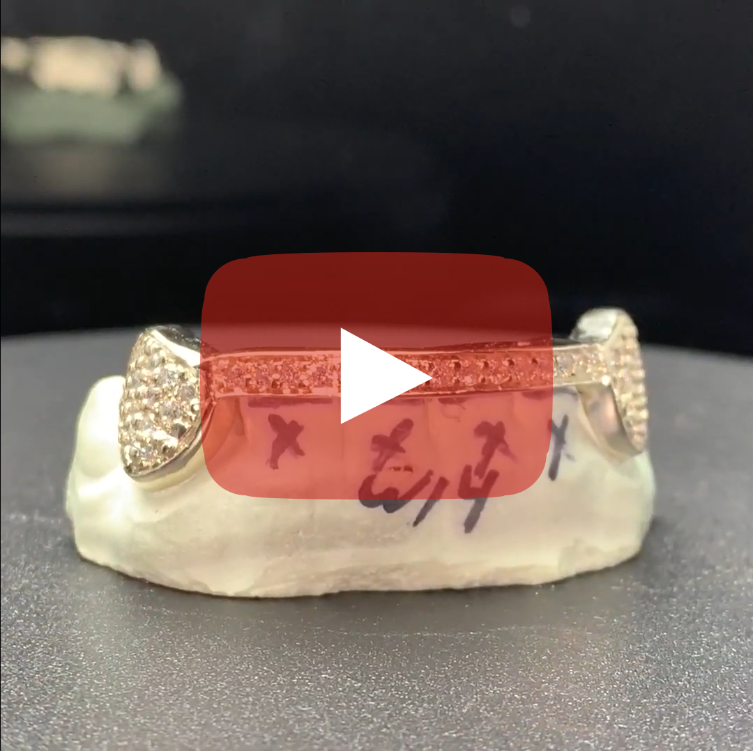 Solid and Iced Bridge Diamond Bar Grillz - Custom Gold Grillz