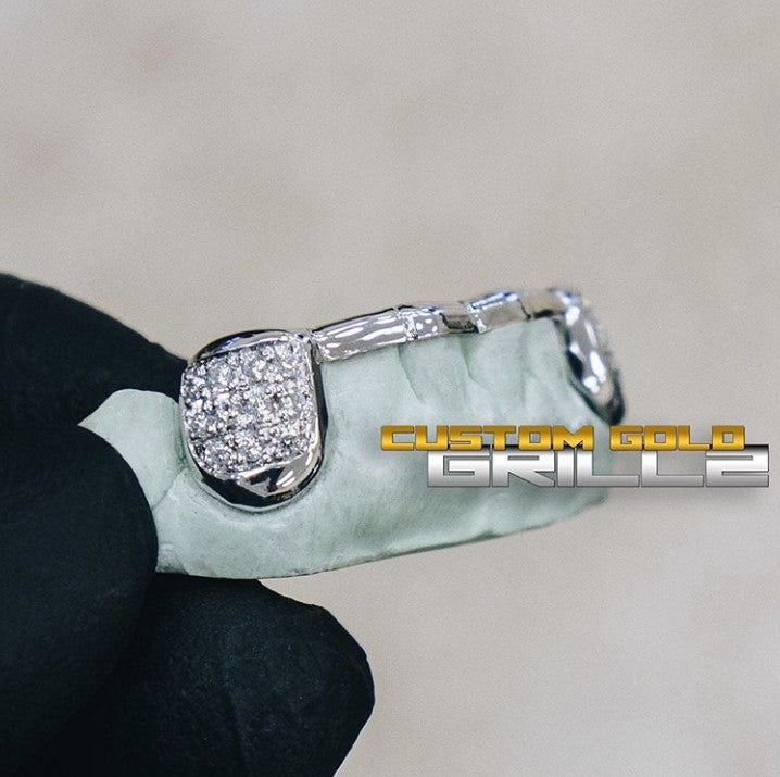 Solid and Iced Bridge Diamond Bar Grillz - Custom Gold Grillz