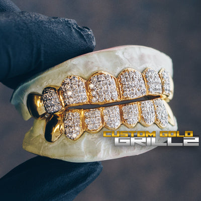Buy Custom Iced Out Grillz - Custom Gold Grillz
