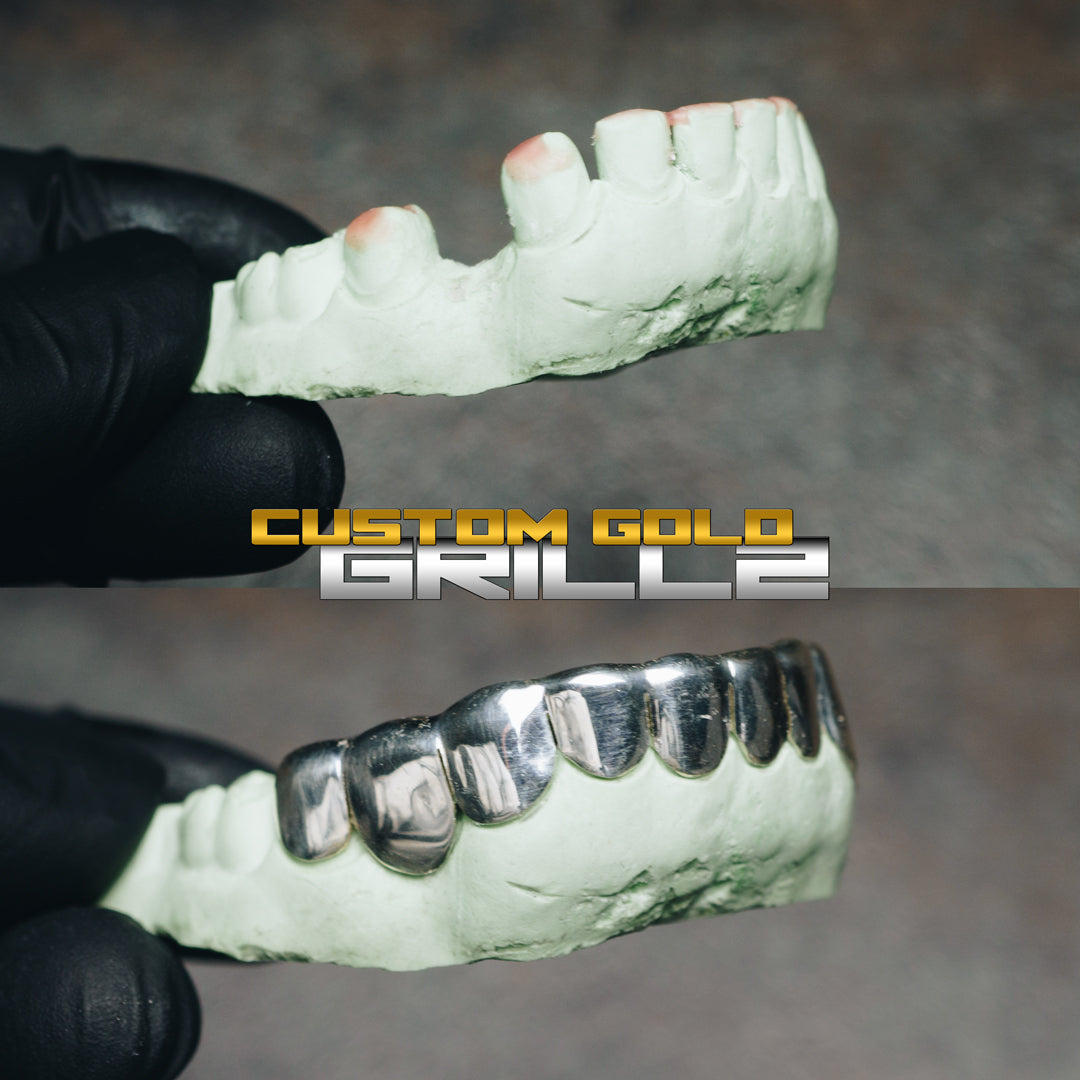 Buy Sterling Silver Grillz & White Gold Teeth - Custom Gold Grillz