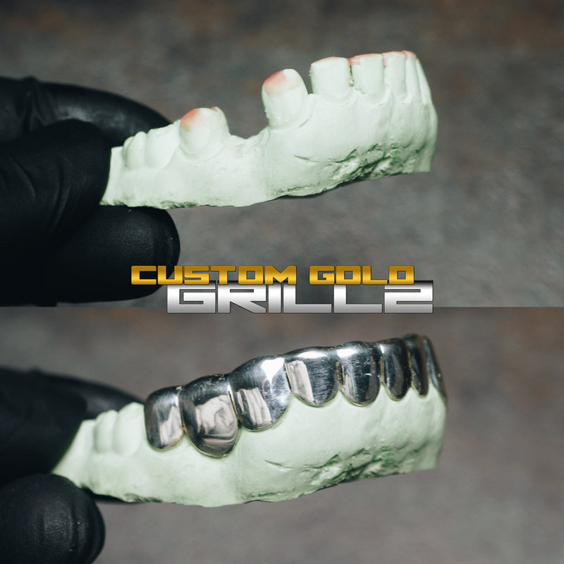 Buy Custom-Fit Solid Sterling Silver Grillz - Custom Gold Grillz