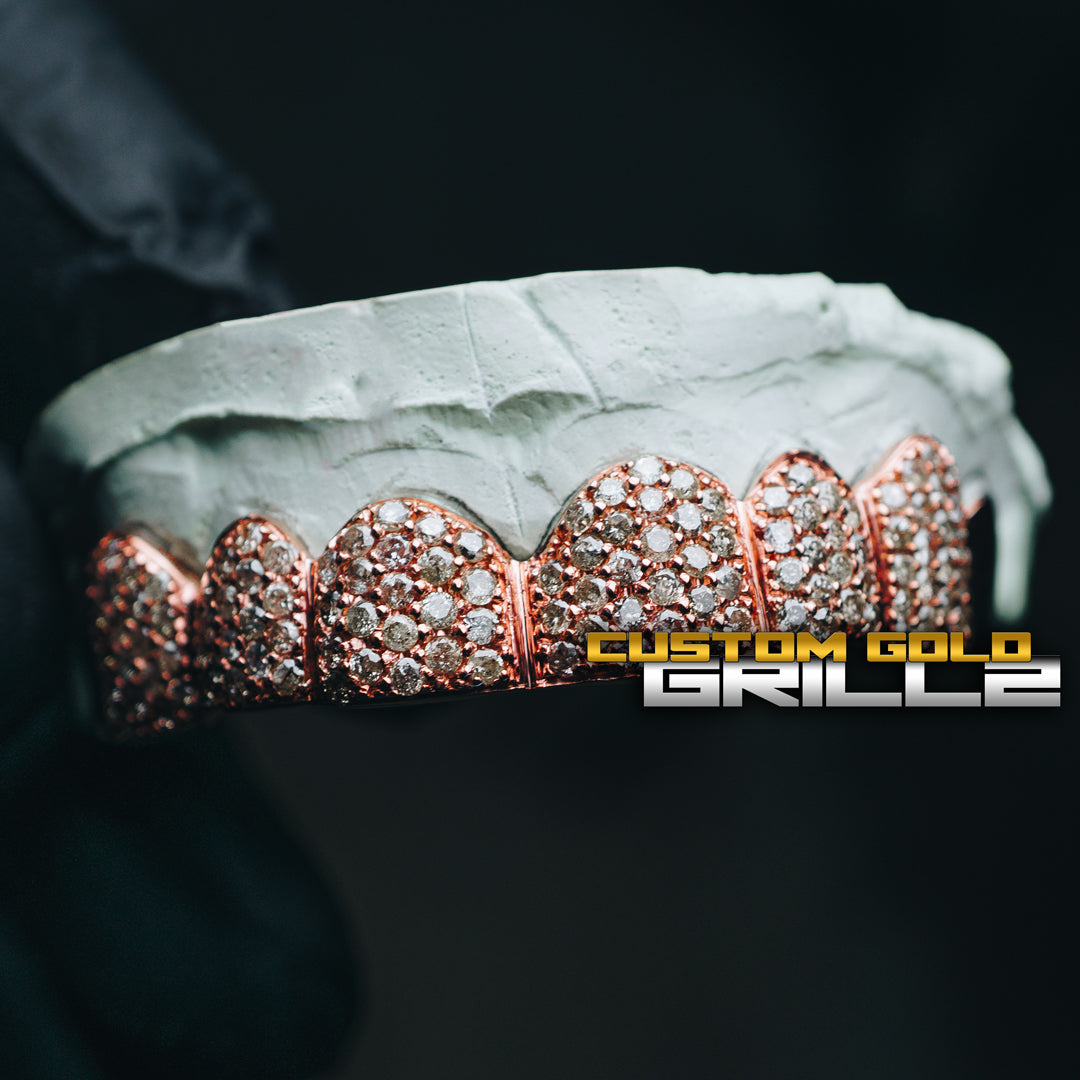 Buy Iced Out Diamond Grillz - Custom Gold Grillz