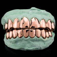 Buy Gold Grillz: Custom & Premade Gold Teeth Online - Custom Gold Grillz