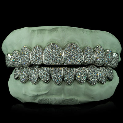 Buy Custom Iced Out Grillz - Custom Gold Grillz