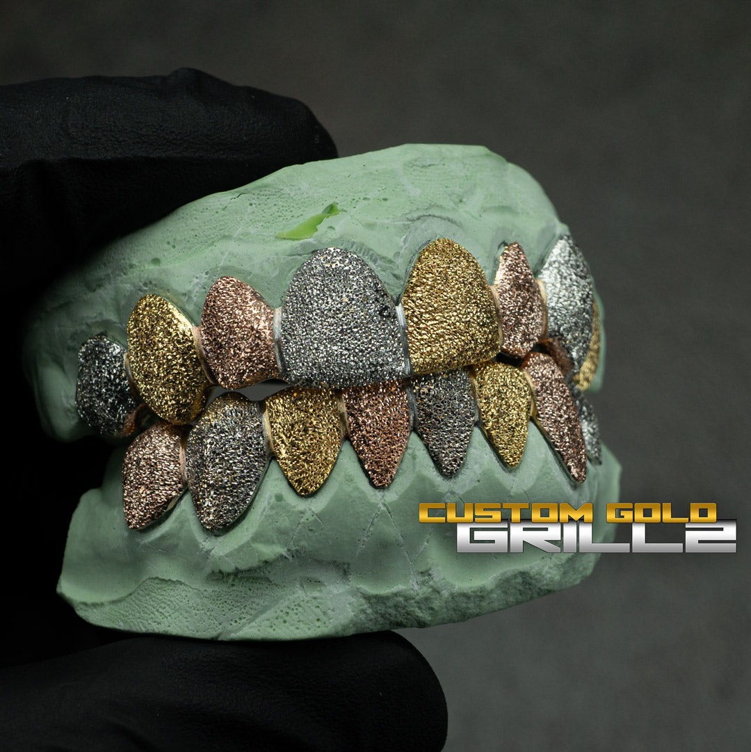 Custom-Fit Tri-Color Diamond Dust Grills - Custom Gold Grillz