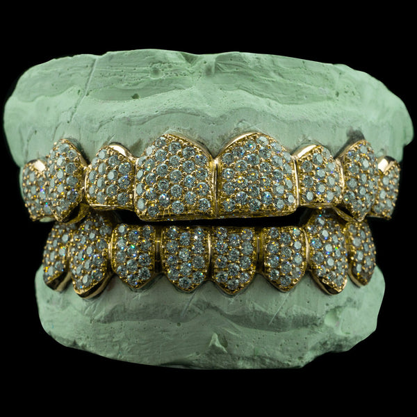 Buy Iced Out Diamond Grillz - Custom Gold Grillz