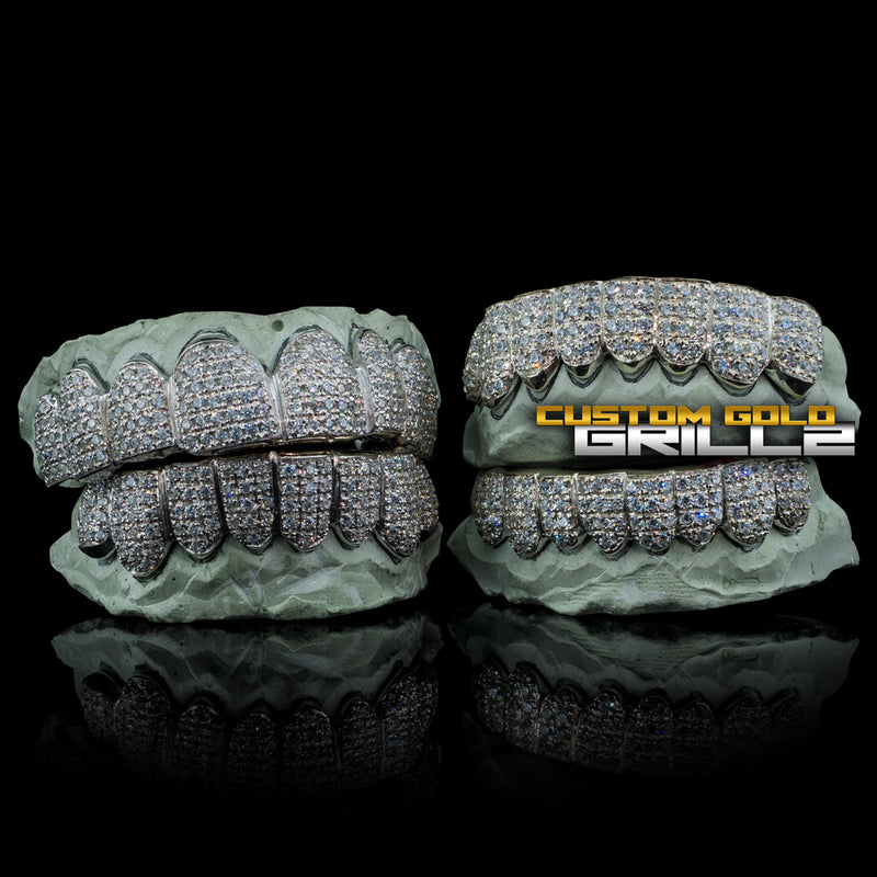 Buy Custom Iced Out Grillz - Custom Gold Grillz