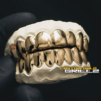 Buy Gold Grillz: Custom & Premade Gold Teeth Online - Custom Gold Grillz
