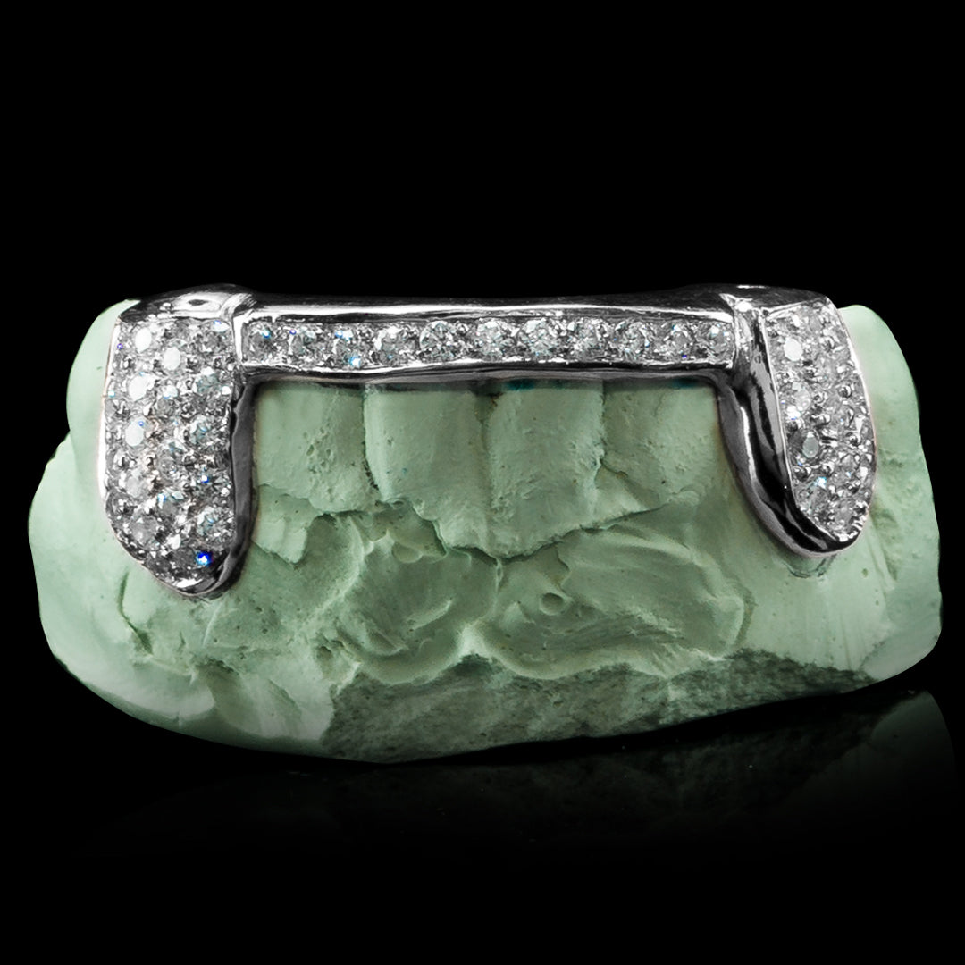 Buy Natural Diamond Grillz - Custom Gold Grillz