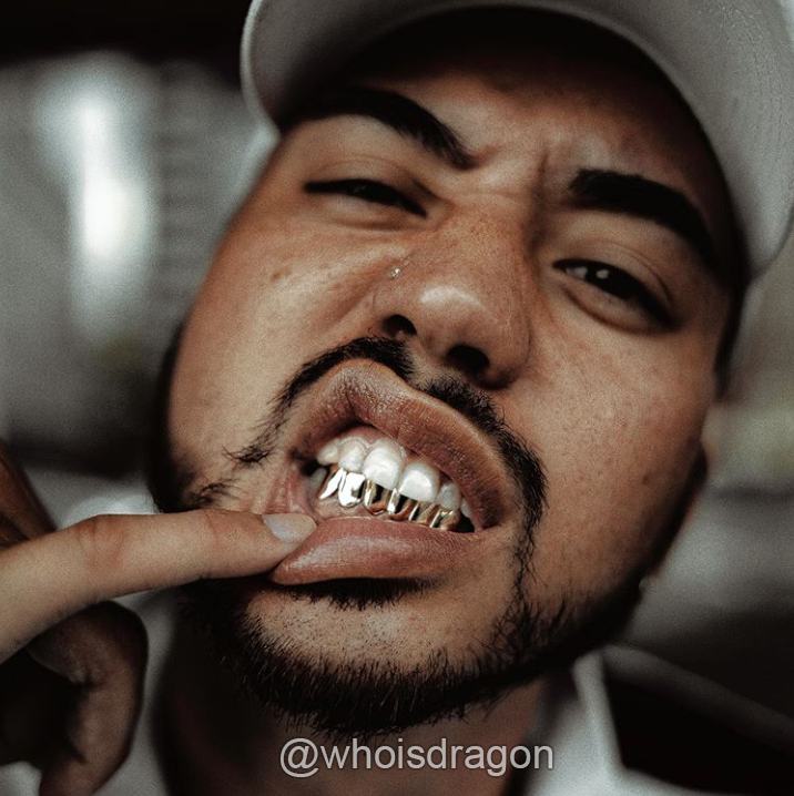 Buy Custom Grillz with Free Mold Kits - Custom Gold Grillz